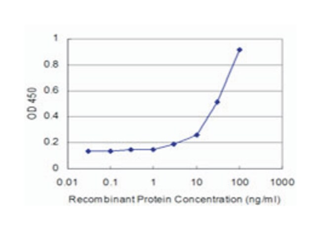 cathepsin K, Mouse, Clone: 2F1, Abnova 100μg; Unlabeled:Anticuerpos ...