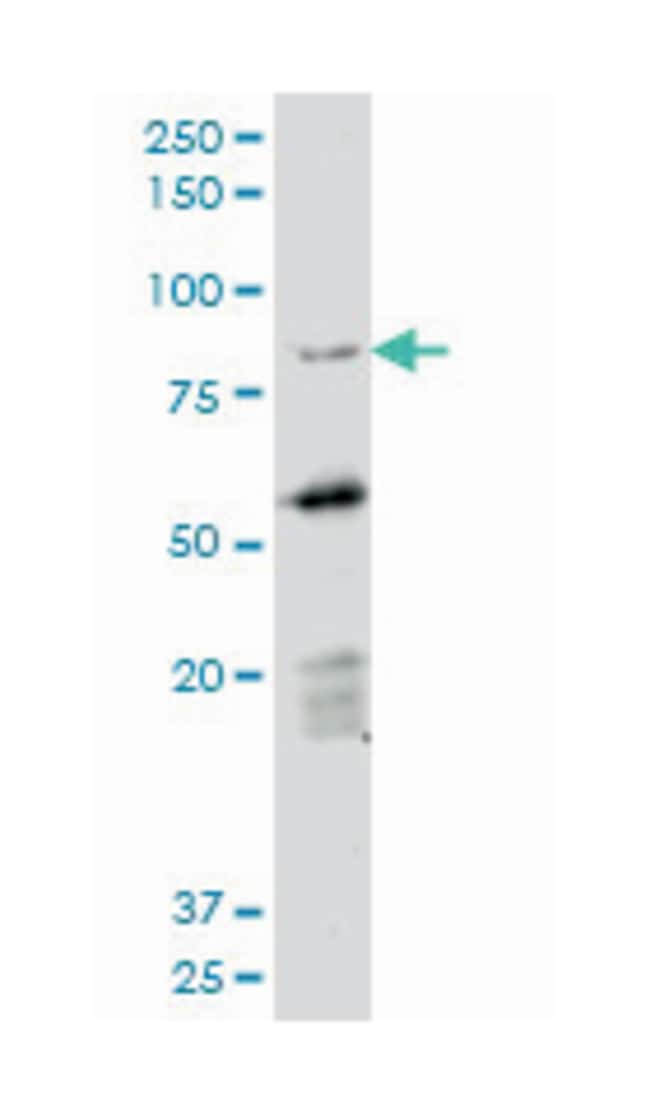 deleted in azoospermia 1, Mouse, Clone: 3E3, Abnova 100μg; Unlabeled ...