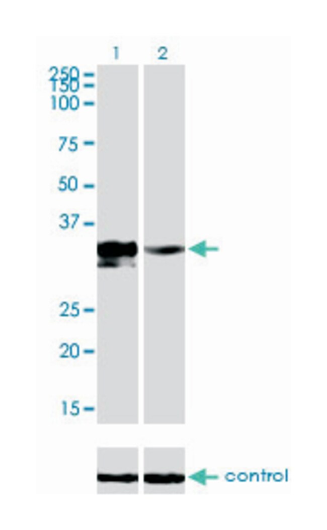 DLX3, Mouse, Clone: 4F8, Abnova™ 100μg; Unlabeled | Fisher Scientific