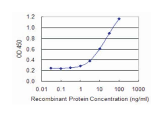 ANTI-TSC22D3 (2B2) 100UG