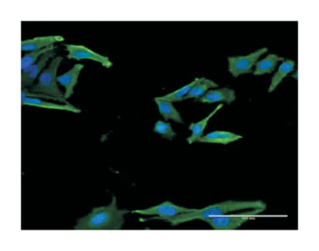 ANTI-EN2 (1E1) 100UG