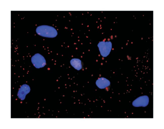 glycogen synthase kinase 3 beta, Mouse, Clone: 1H3, Abnova 100μg ...
