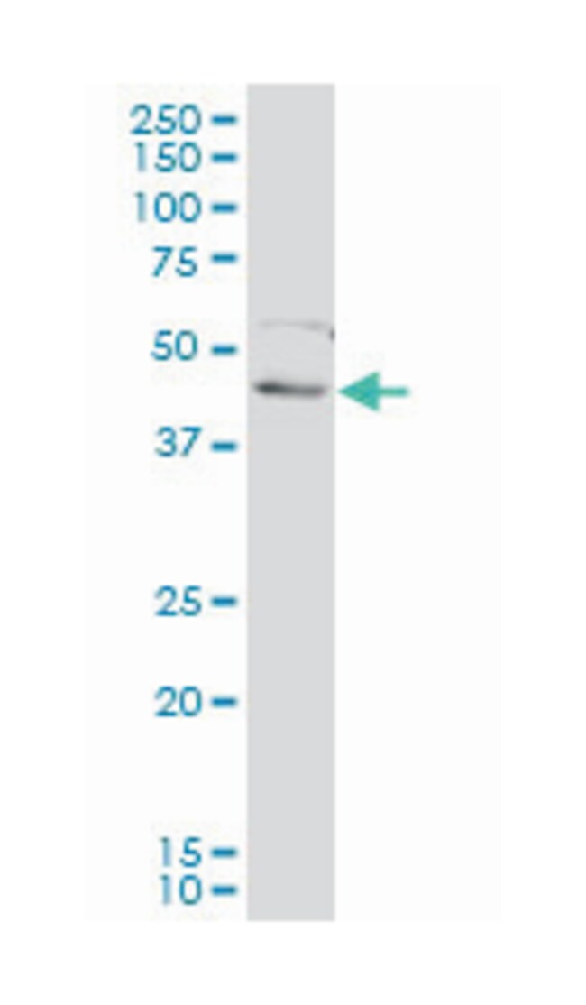 FOXF2, Mouse, Clone: 2D7, Abnova™ 100μg; Unlabeled | Fisher Scientific