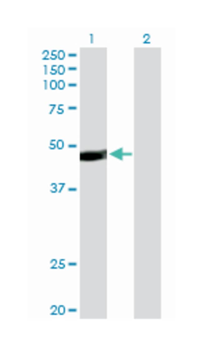 paired box 5, Rabbit, Purified MaxPab™ Polyclonal Antibody, Abnova ...
