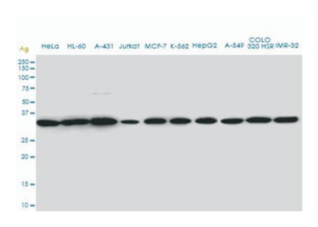 ANTI-SUPT3H (1A6) 200UL
