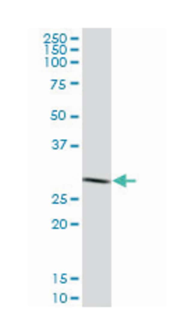 GCLM, Mouse, Clone: 3A10, Abnova 100μg; Unlabeled:Antibodies ...