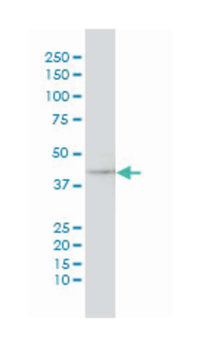 mitogen-activated protein kinase 12, Mouse, Clone: 2C1, Abnova ...