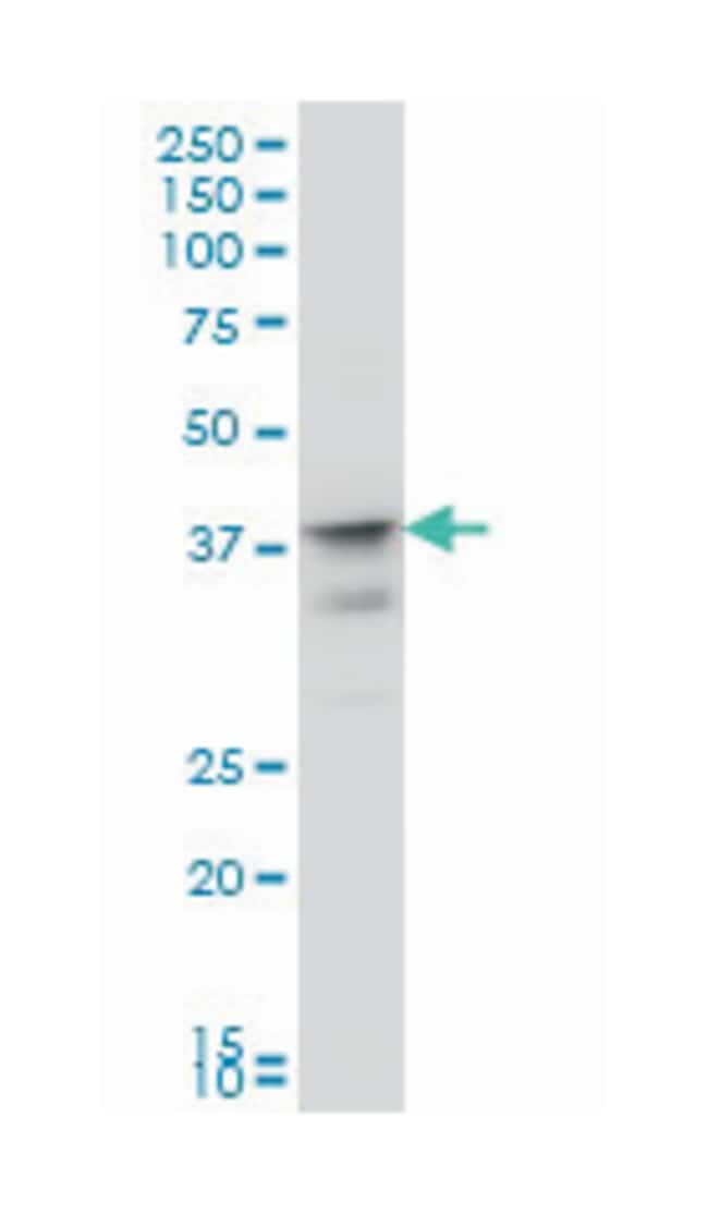 musashi homolog 1 (Drosophila), Mouse, Clone: 3F2, Abnova™ 100μg ...