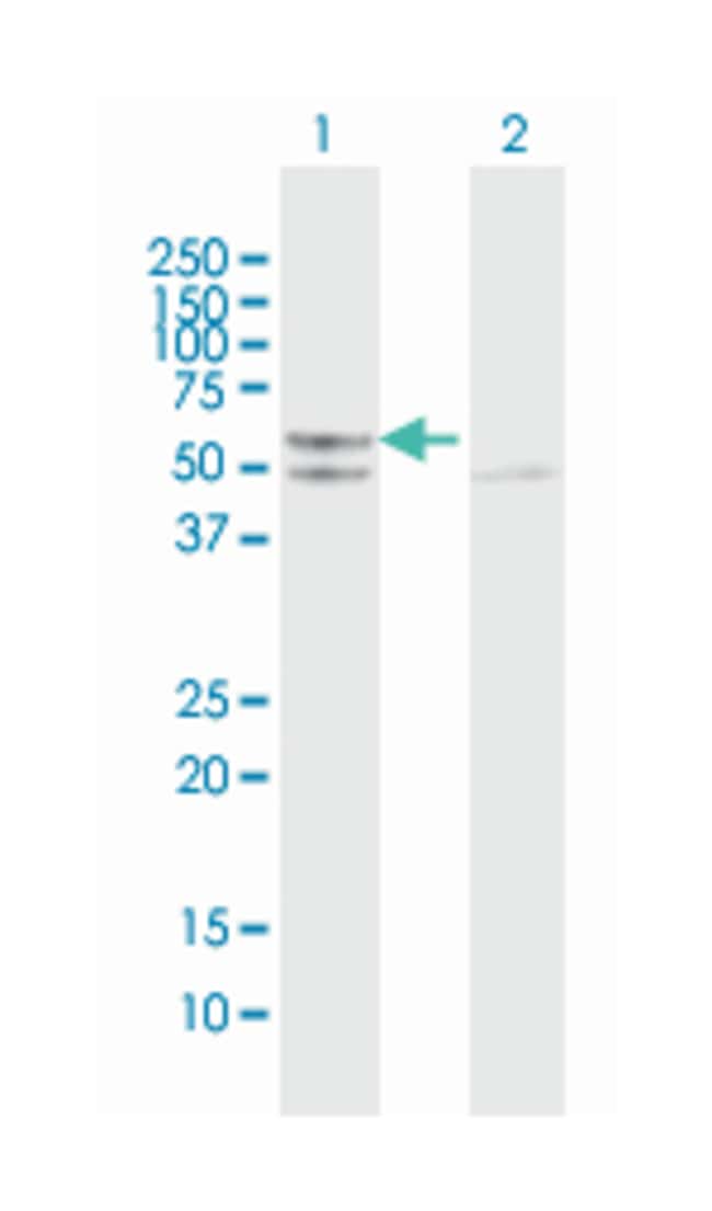 ANTI-TUFM MAXPAB 50UG