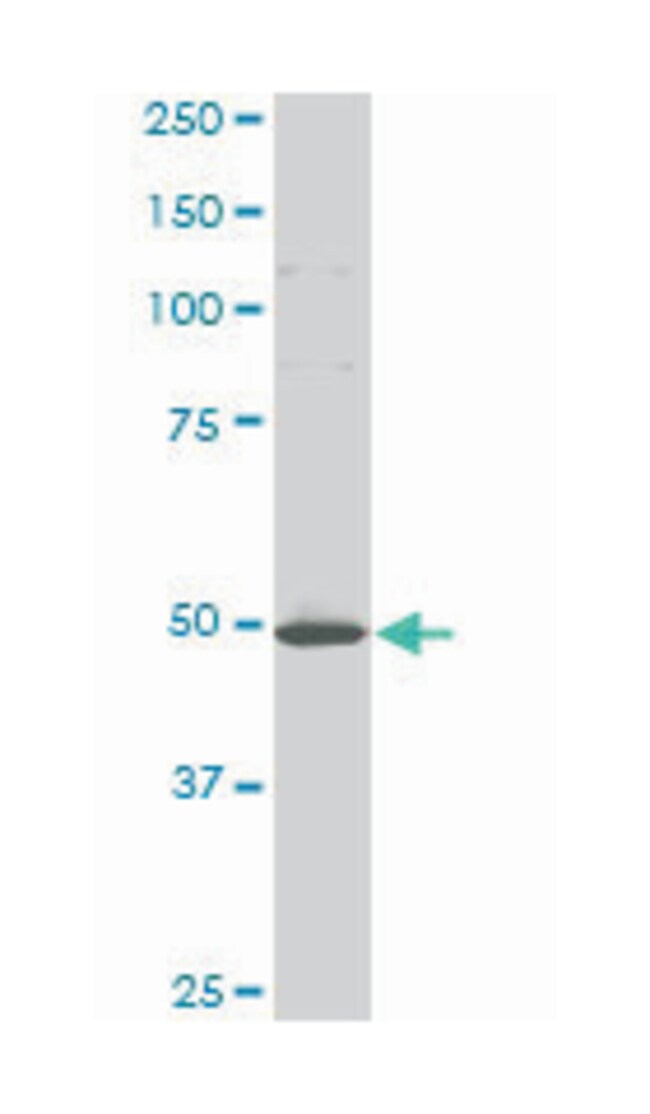 huntingtin, Mouse, Clone: 3F1, Abnova 100μg; Unlabeled:Anticuerpos ...