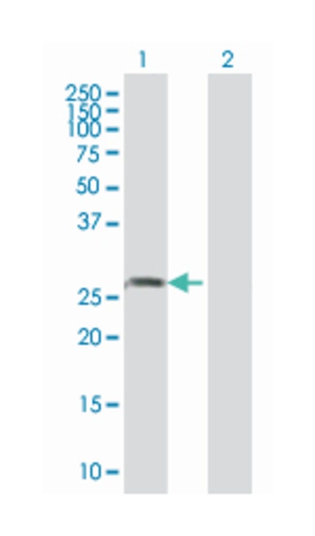 ANTI-HLA-DRB5 MAXPAB 50UL