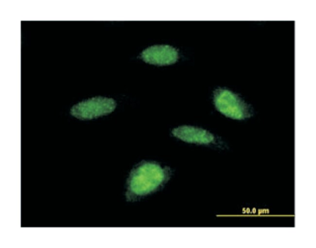 ribosomal protein S6 kinase, 70kDa, polypeptide 2, Mouse, Clone: 4B11 ...