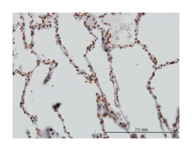 serum/glucocorticoid regulated kinase 1, Mouse, Clone: 3E3, Abnova ...