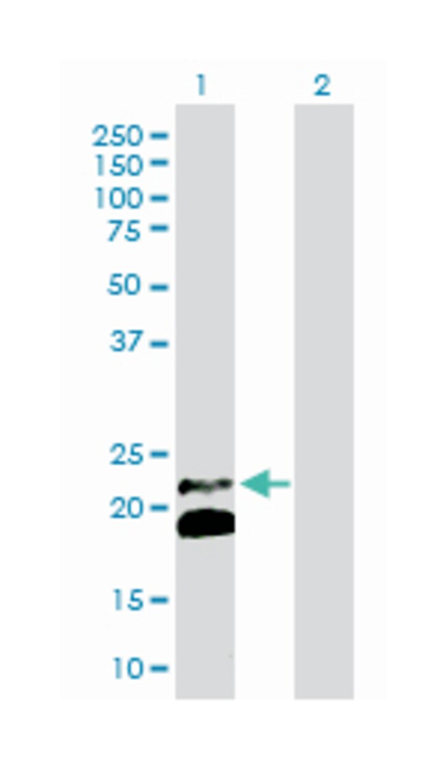 interferon, beta 1, fibroblast, Rabbit, Purified MaxPab Polyclonal ...