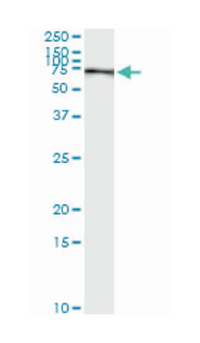 phosphoenolpyruvate carboxykinase 1 (soluble), Mouse, Clone: 3E4 ...