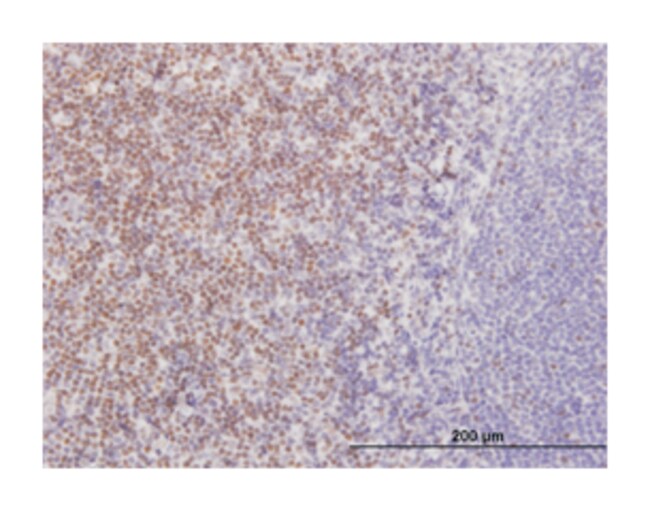 ANTI-TCF7 (2E9) 100UG