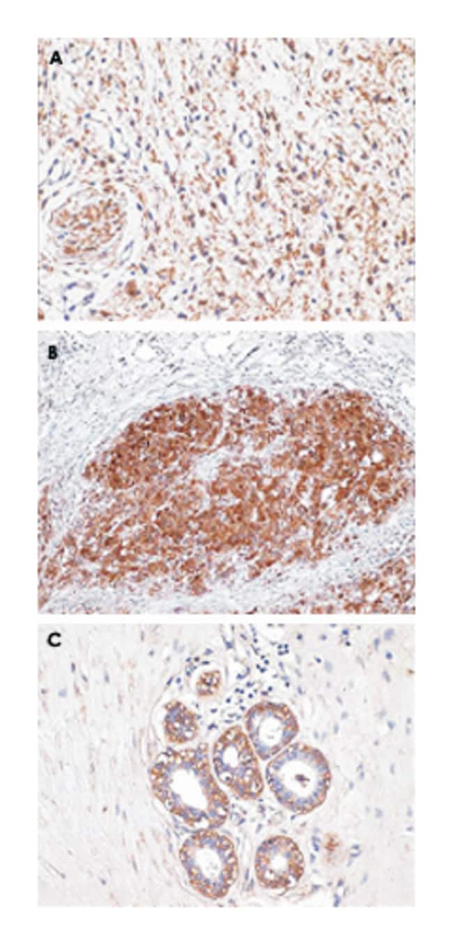 S100A1, Rabbit, Clone: D28-E, Abnova 100μL; Unlabeled:Antibodies ...