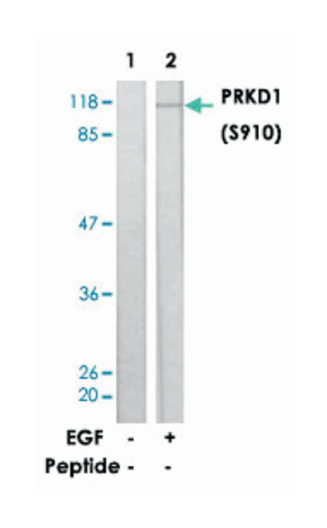 ANTI-PRKD1 ANTIBODY 100UG