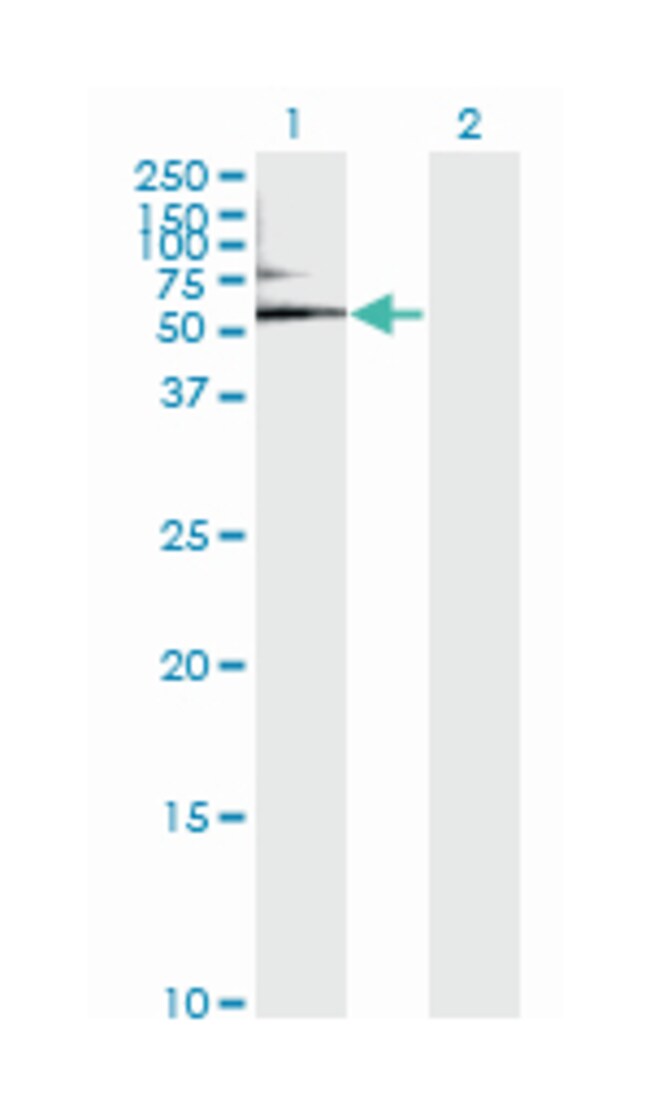 ANTI-ALB (1G12-1B3) 100UG