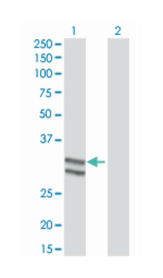 SERPINC1 (M02A), Mouse anti-Human, Clone: 2B12, Abnova™ | Fisher Scientific