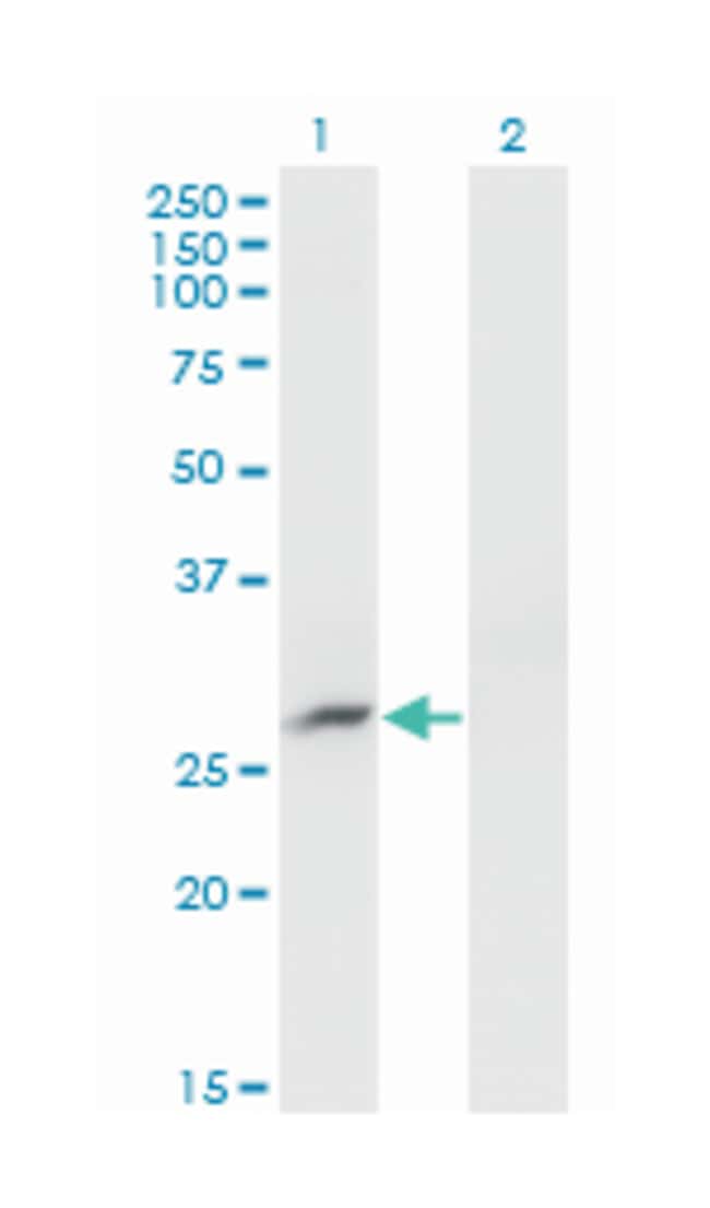 ANTI-CRYBB3 (4H6) 100UG