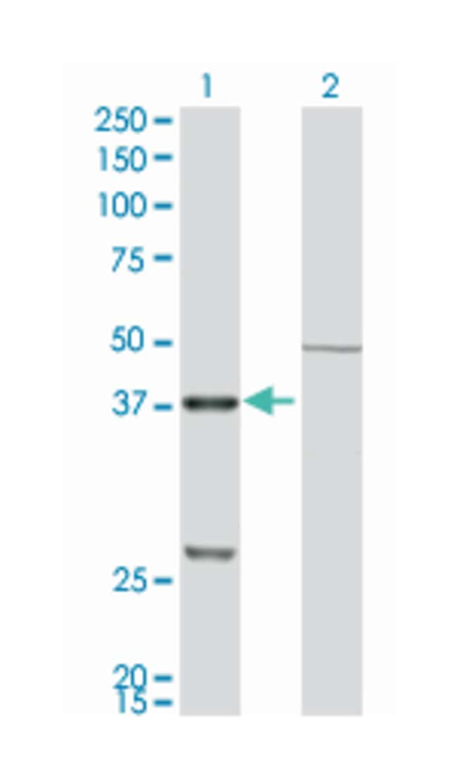 cathepsin K, Mouse, Clone: 2F1, Abnova 100μg; Unlabeled:Anticuerpos ...