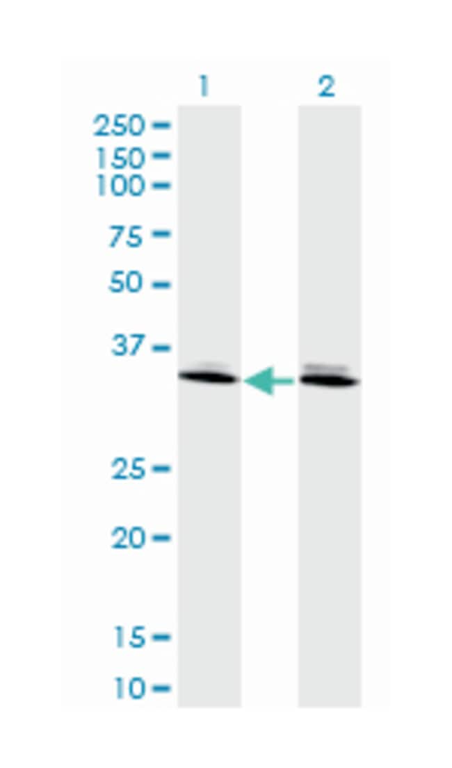 ANTI-DLX6 (2D7) 100UG