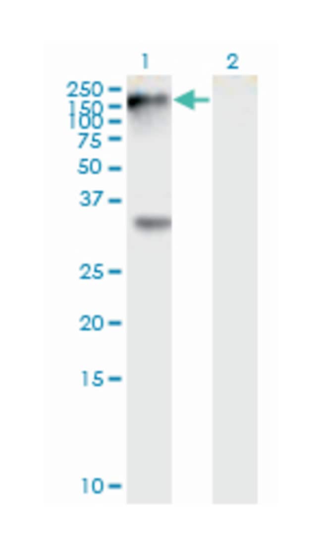 EPHB1, Mouse, Clone: 4G6, Abnova™ | Fisher Scientific