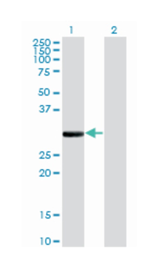 ANTI-FCN1 (2B7) 100UG