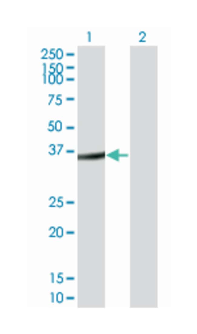 frizzled-related protein, Mouse, Clone: 1H8, Abnova™ 100μg; Unlabeled ...