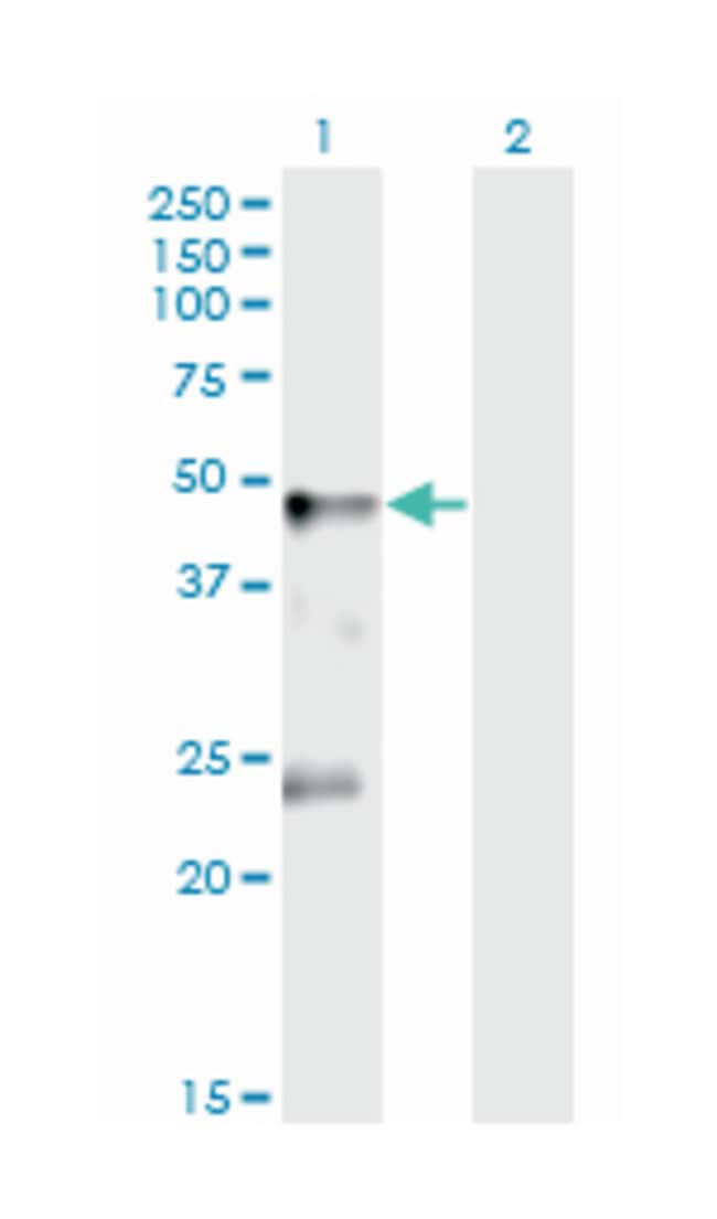 GLRA1, Mouse, Clone: 2E7, Abnova™ | Fisher Scientific