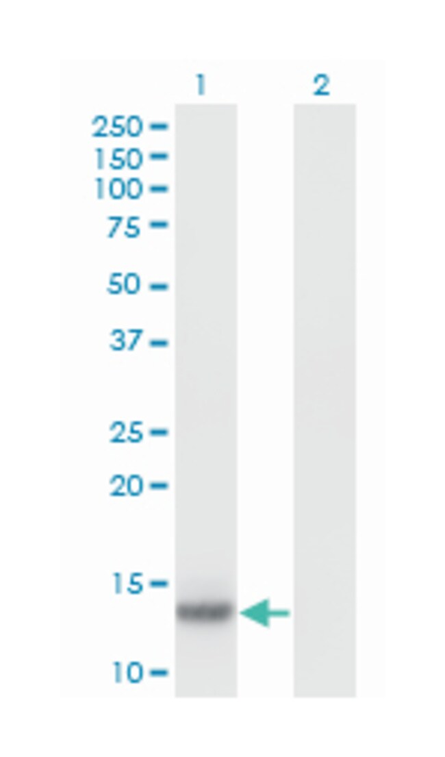 ANTI-IL2 (1C5) 100UG