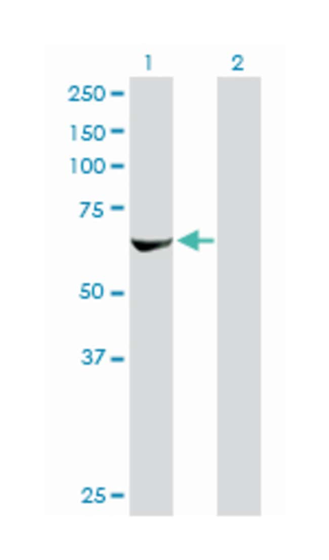 ribosomal protein S6 kinase, 70kDa, polypeptide 2, Mouse, Clone: 4B11 ...