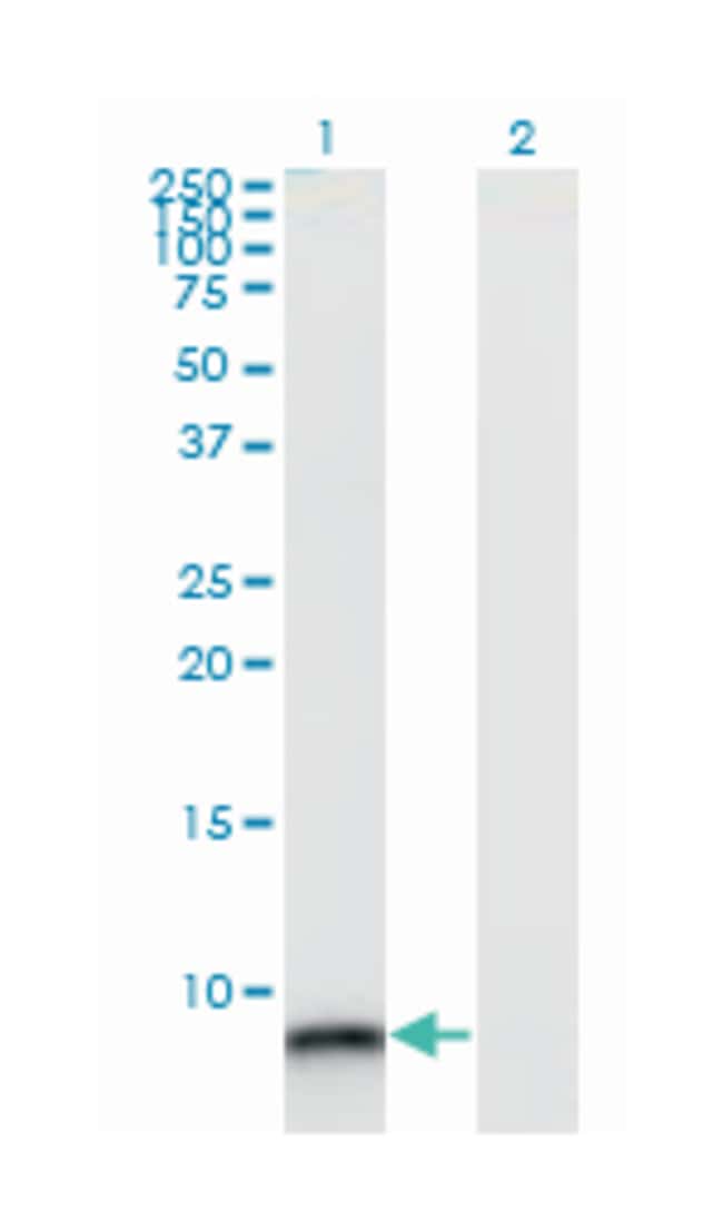 S100A12, Mouse, Clone: 1F10, Abnova™ 200μL; Unlabeled | Fisher Scientific
