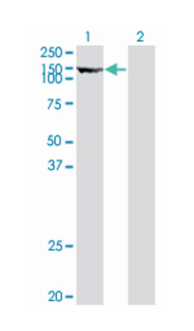 TPO, Mouse, Clone: 2A11, Abnova 100μg; Unlabeled:Anticuerpos | Fisher ...