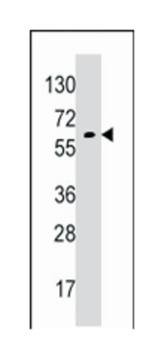 ANTI-GPC6 ANTIBODY 400UL