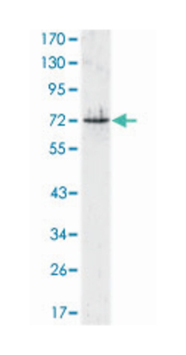 ANTI-PRTN3 ANTIBODY 100UL