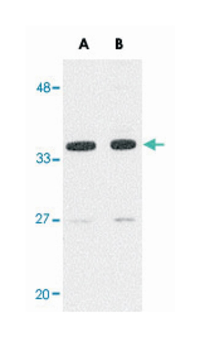SLC39A11, Rabbit, Polyclonal Antibody, Abnova 100µg; Unlabeled:Life ...