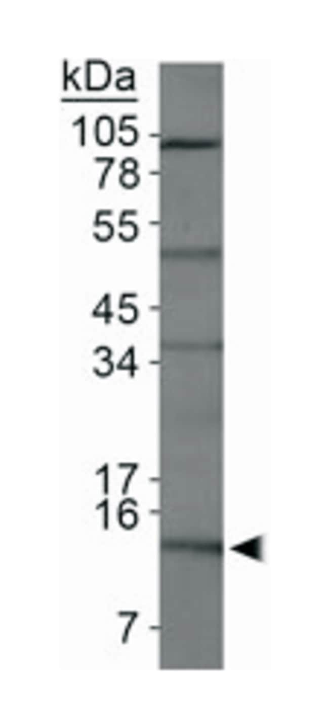ANTI-S100A12 ANTIBODY 100UL