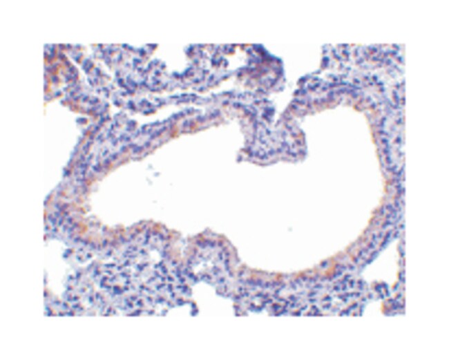 ANTI-SLPI ANTIBODY 100UG
