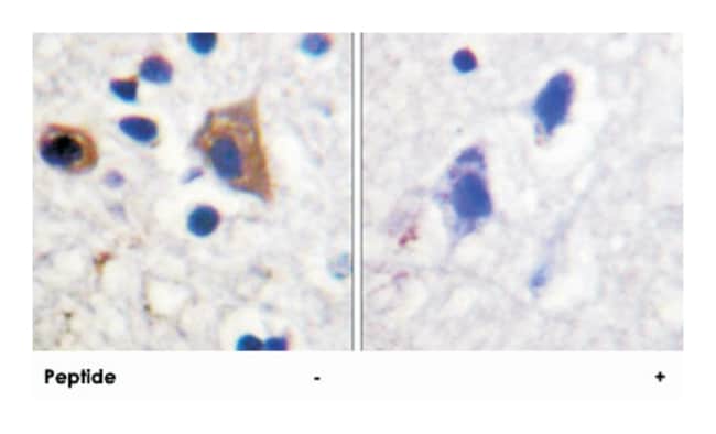 ANTI-PIP5K3 ANTIBODY 100UG