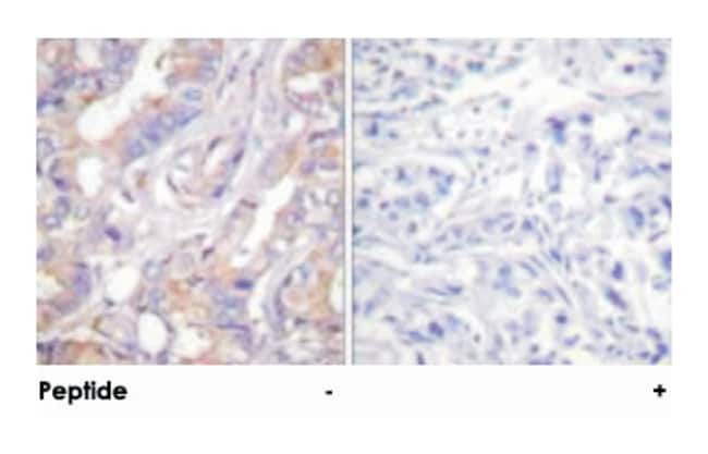 ANTI-ARAF ANTIBODY 100UG