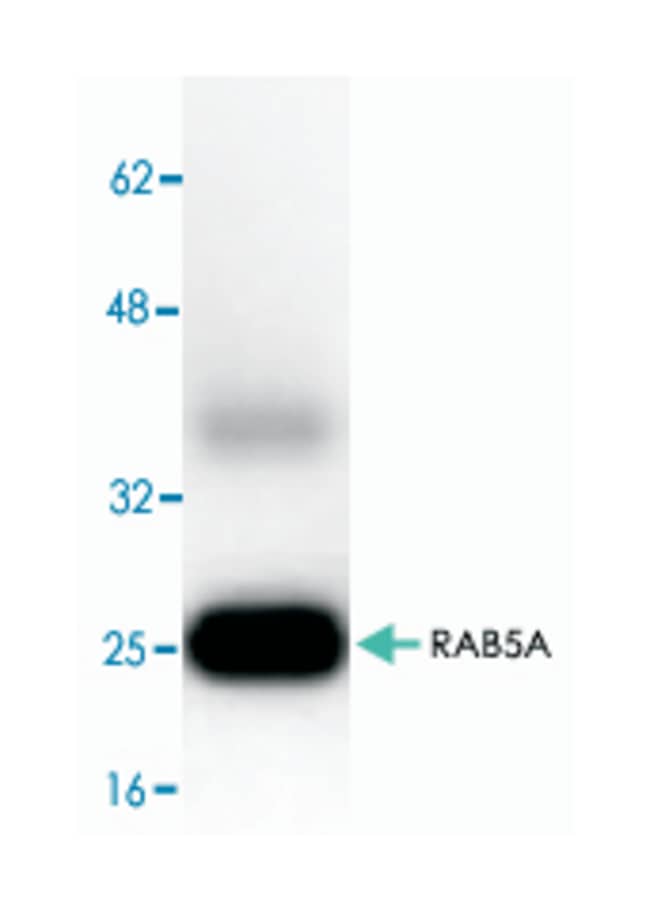 ANTI-RAB5A ANTIBODY 100UG
