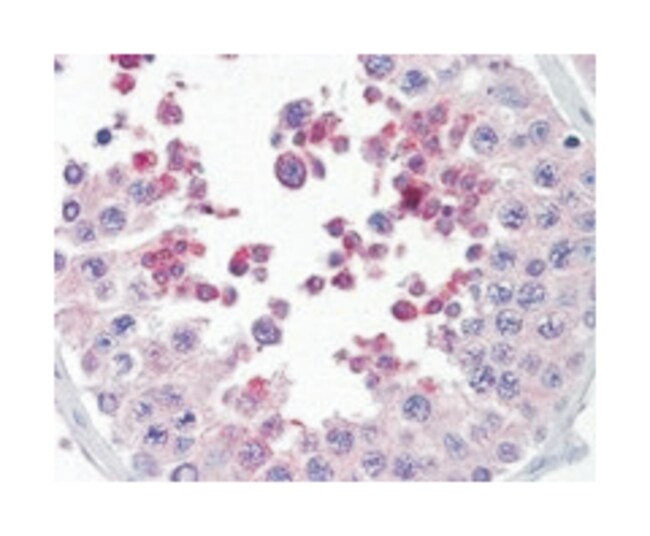 MLL4, Goat, Polyclonal Antibody, Abnova 100μg; Unlabeled:Antibodies ...