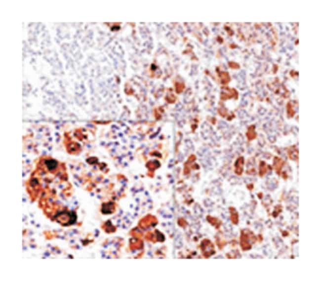 POMC, Mouse, Clone: SPM333, Abnova 100μg; Unlabeled:Antibodies ...