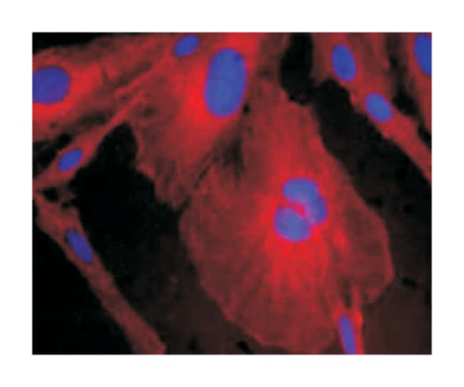 GFAP, Mouse, Cy3, Clone: SB61b, Abnova™ 500μg; Cy3 Primary Antibodies ...