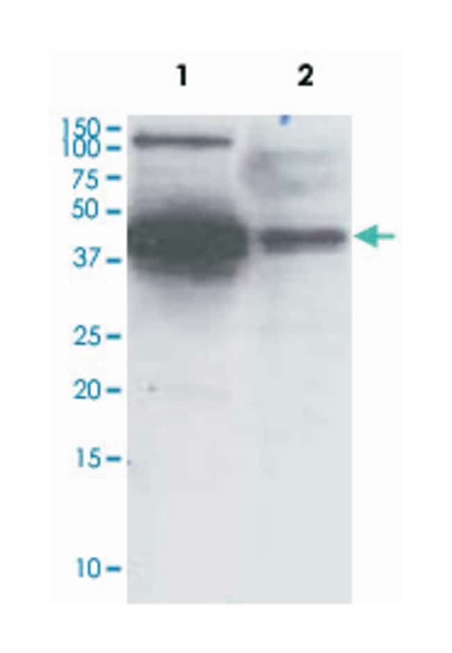 MAPK1/MAPK3, Mouse, Biotin, Clone: SB46b, Abnova 500μg; Biotin:Antibodies, | Fisher Scientific