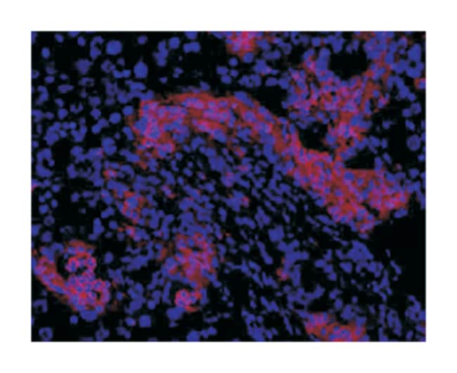 OVAL CELL MARKER MAB