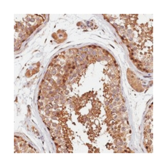 ANTI-SEMA3C ANTIBODY 100UL