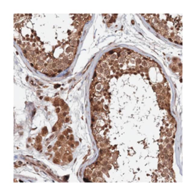 ANTI-CEP192 ANTIBODY 100UL
